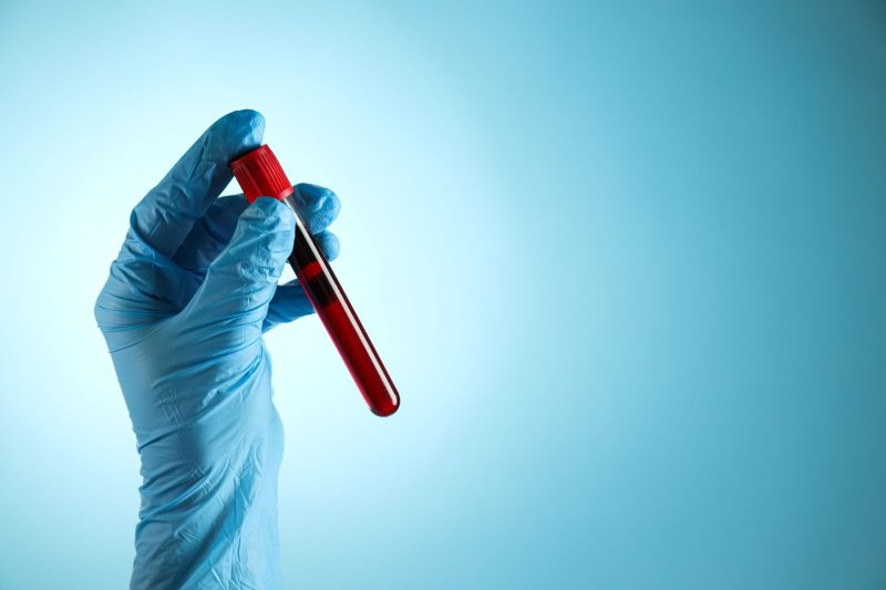 Hemab Therapeutics wins FDA breakthrough therapy status for sutacimig ...